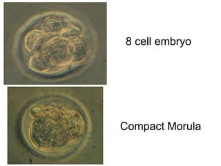 17 ther 608 early embryogensis | PPT