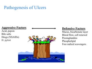 peptic ulcer management and Treatment ppt | PPT | Digestive Disorders ...