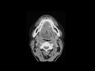 CT Interesting cases 17/01/2015 | PPTX