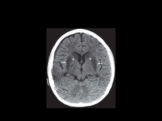 CT Interesting cases 17/01/2015 | PPTX