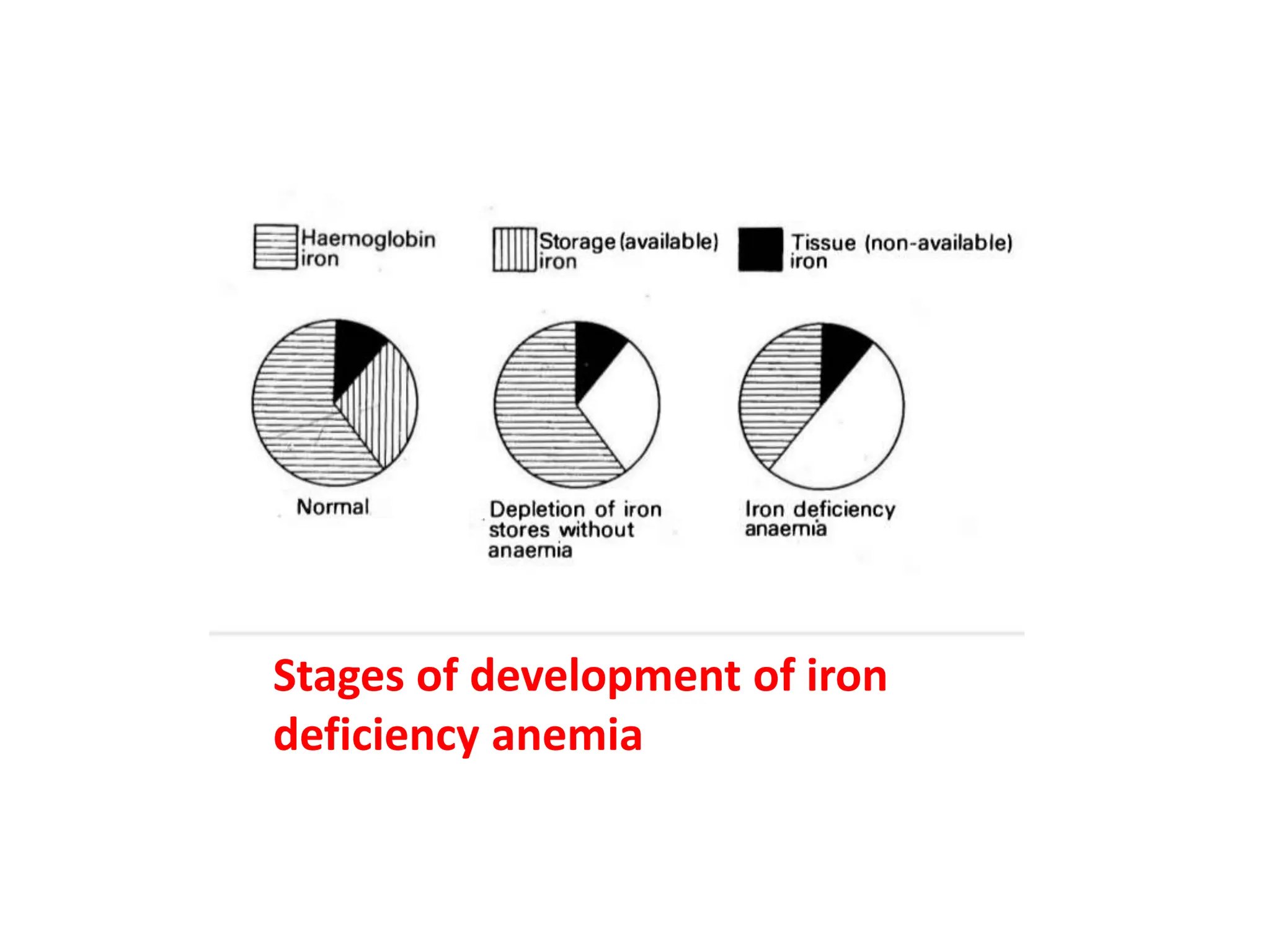 Iron Deficiency Anemia And Classification of Anaemia | PPTX