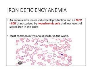 Iron Deficiency Anemia And Classification of Anaemia | PPTX | Blood ...