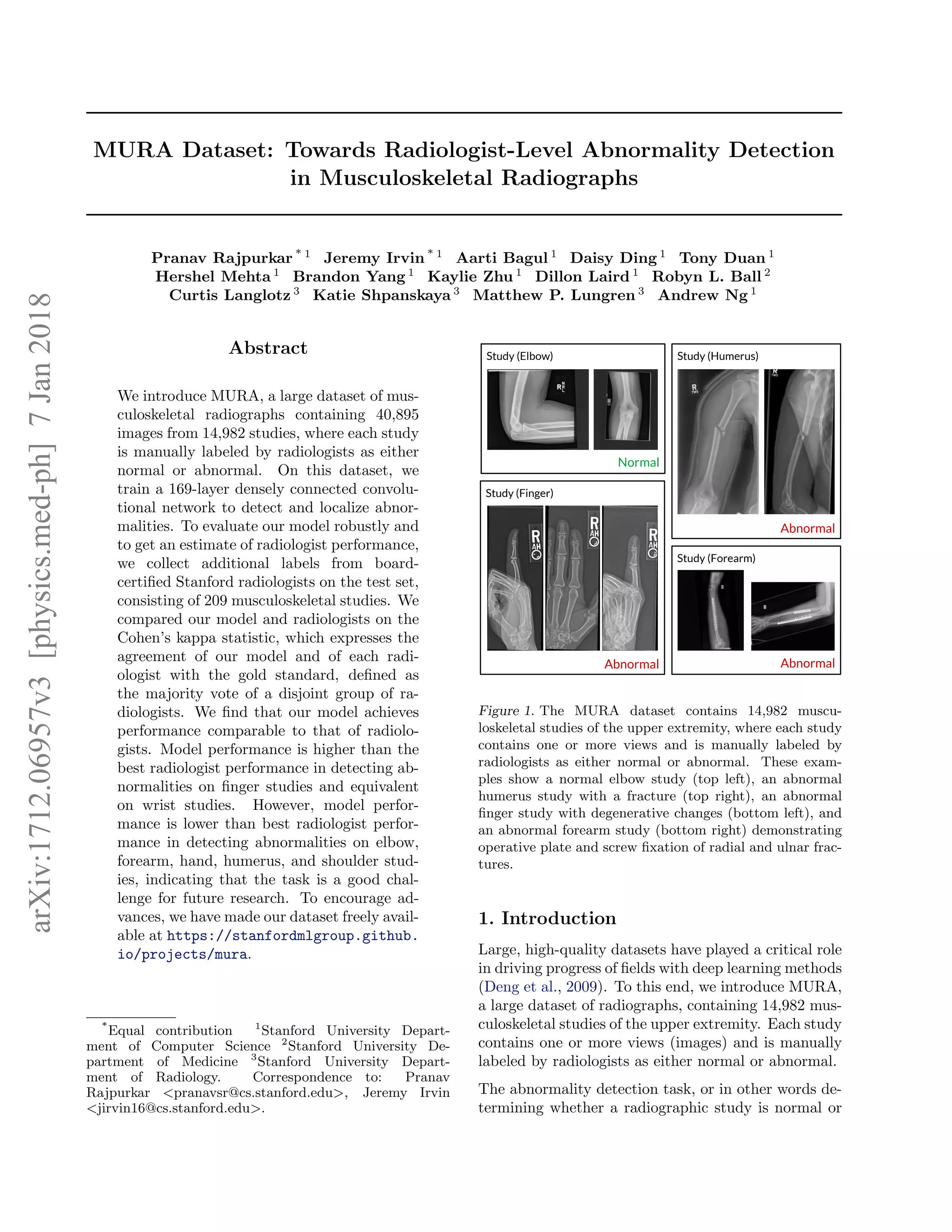 MURA Dataset: Towards Radiologist-Level Abnormality Detection in ...