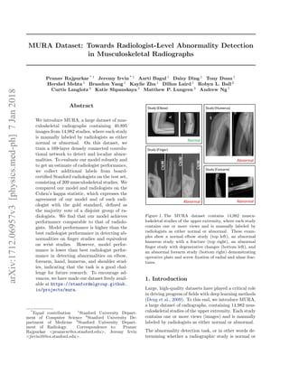 MURA Dataset: Towards Radiologist-Level Abnormality Detection in Musculoskeletal Radiographs | PDF