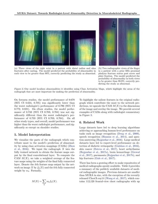 MURA Dataset: Towards Radiologist-Level Abnormality Detection in ...