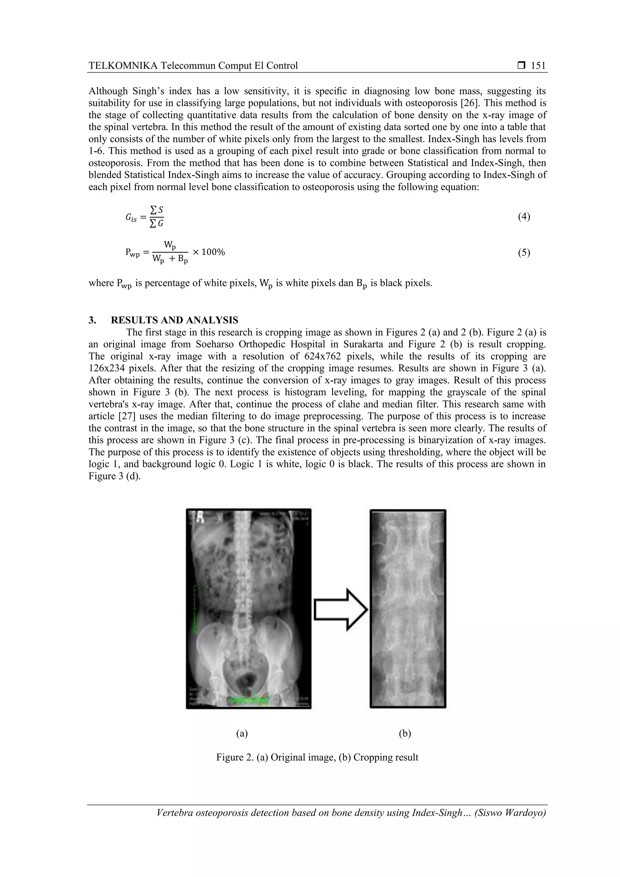 Vertebra Osteoporosis Detection Based On Bone Density Using Index Singh