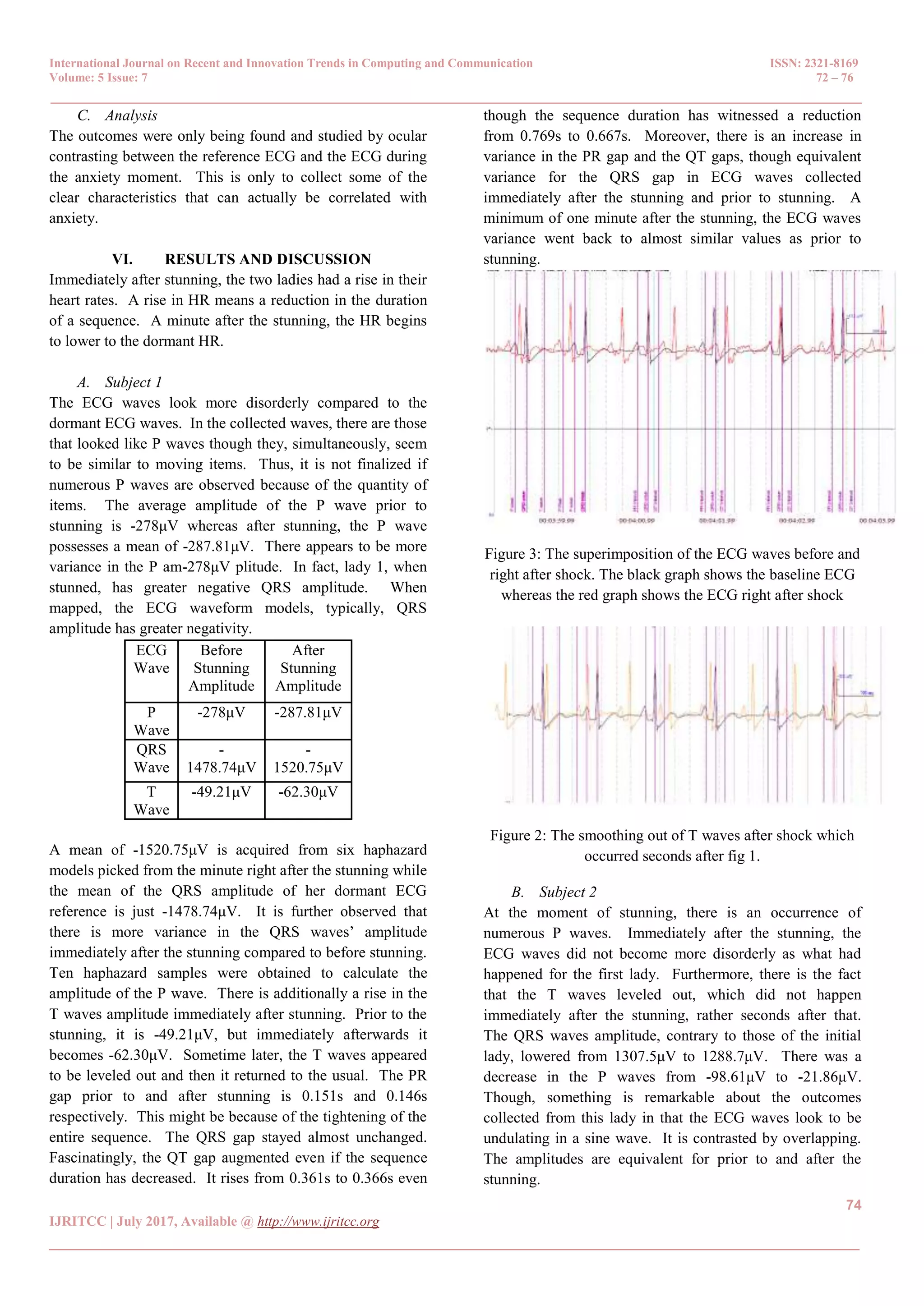 A Review of ECG signals for Human Emotion Detection | PDF