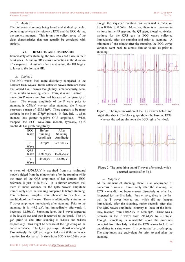 A Review of ECG signals for Human Emotion Detection | PDF