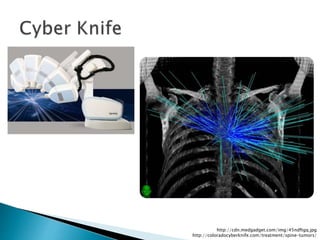 challenges of small field dosimetry | PPTX