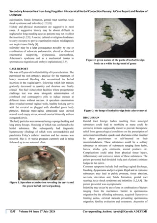 Secondary Amenorrhea from Long Forgotten Intracervical Herbal ...