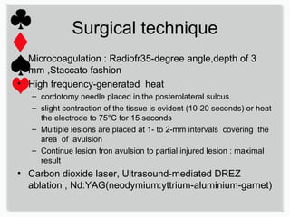 171&Sch ch130 Dorsal root entry zone lesion (DREZ) | PPT