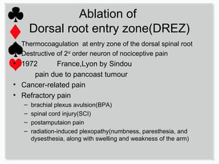 171&Sch ch130 Dorsal root entry zone lesion (DREZ) | PPT