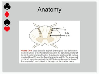 171&Sch ch130 Dorsal root entry zone lesion (DREZ) | PPT