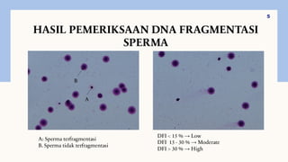 Pemeriksaan Analisa Sperma Mikroskopik untuk melihat morfologi | PDF