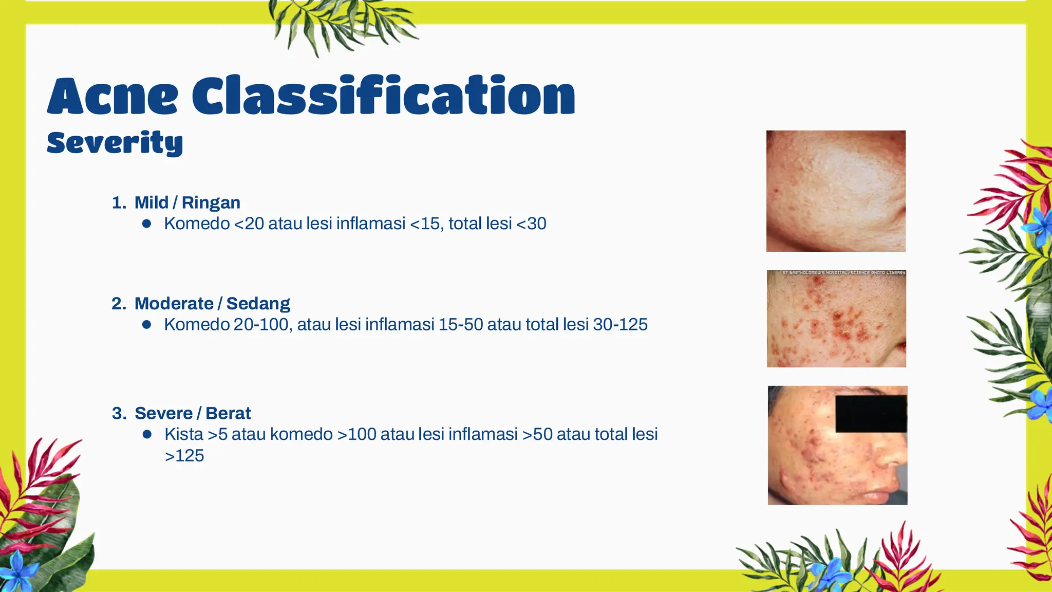 Tatalaksana Acne Vulgaris dengan Terapi Kombinasi | PDF