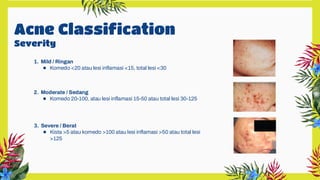 Tatalaksana Acne Vulgaris dengan Terapi Kombinasi | PDF