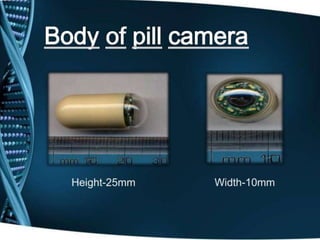 Pill Camera | PPT
