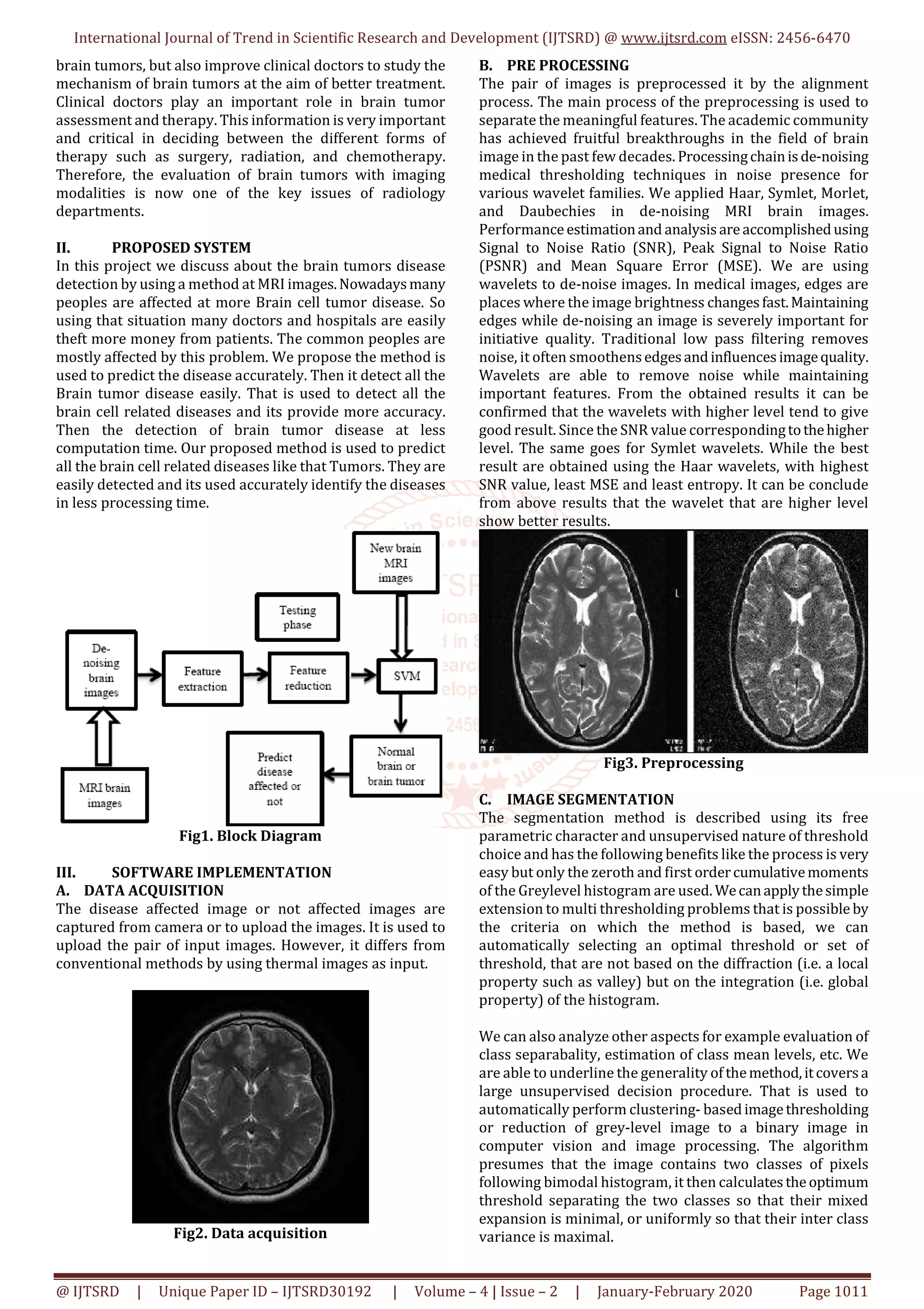Tumor Detection And Classification Of Mri Brain Images Using Svm And
