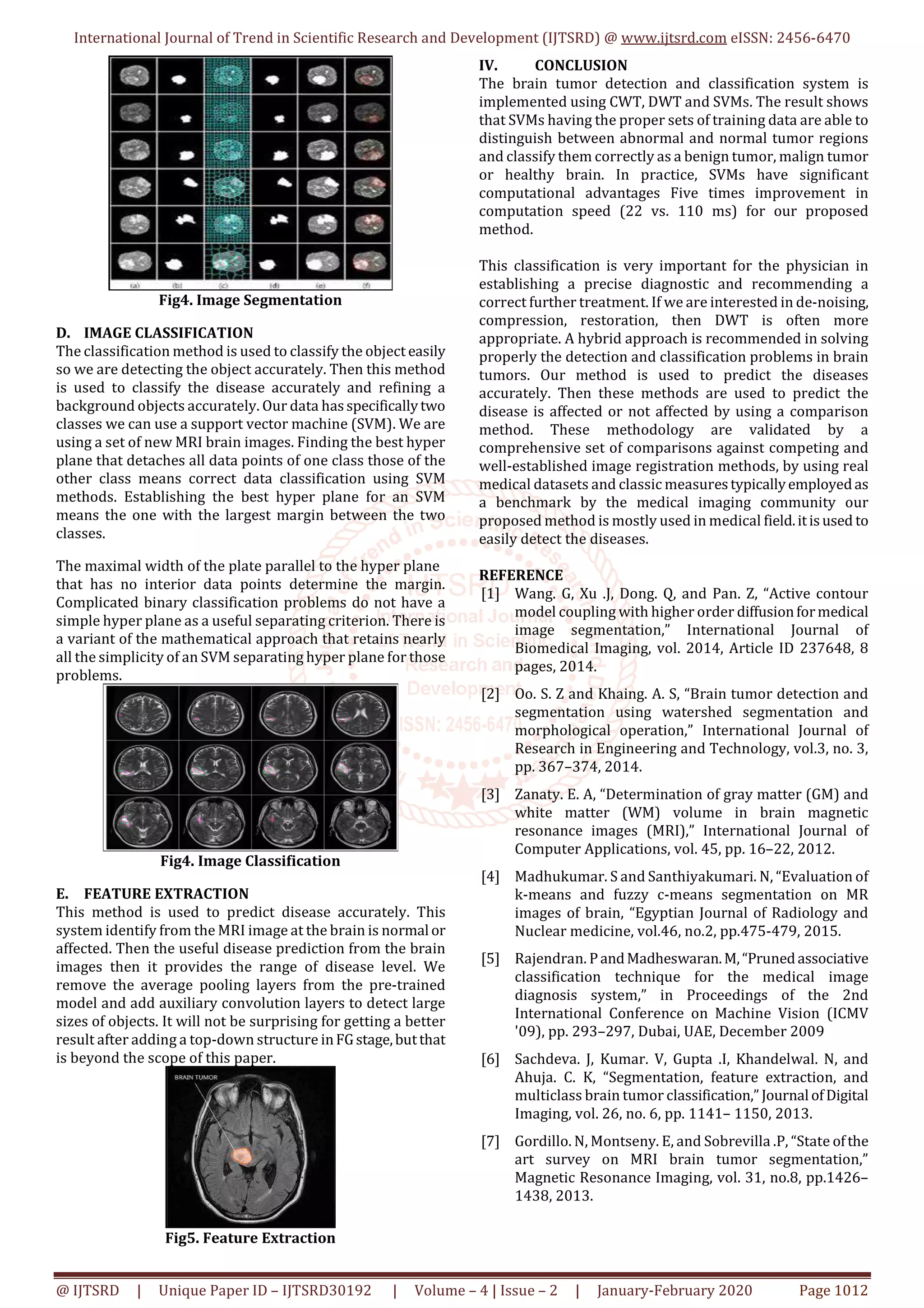 Tumor Detection And Classification Of Mri Brain Images Using Svm And