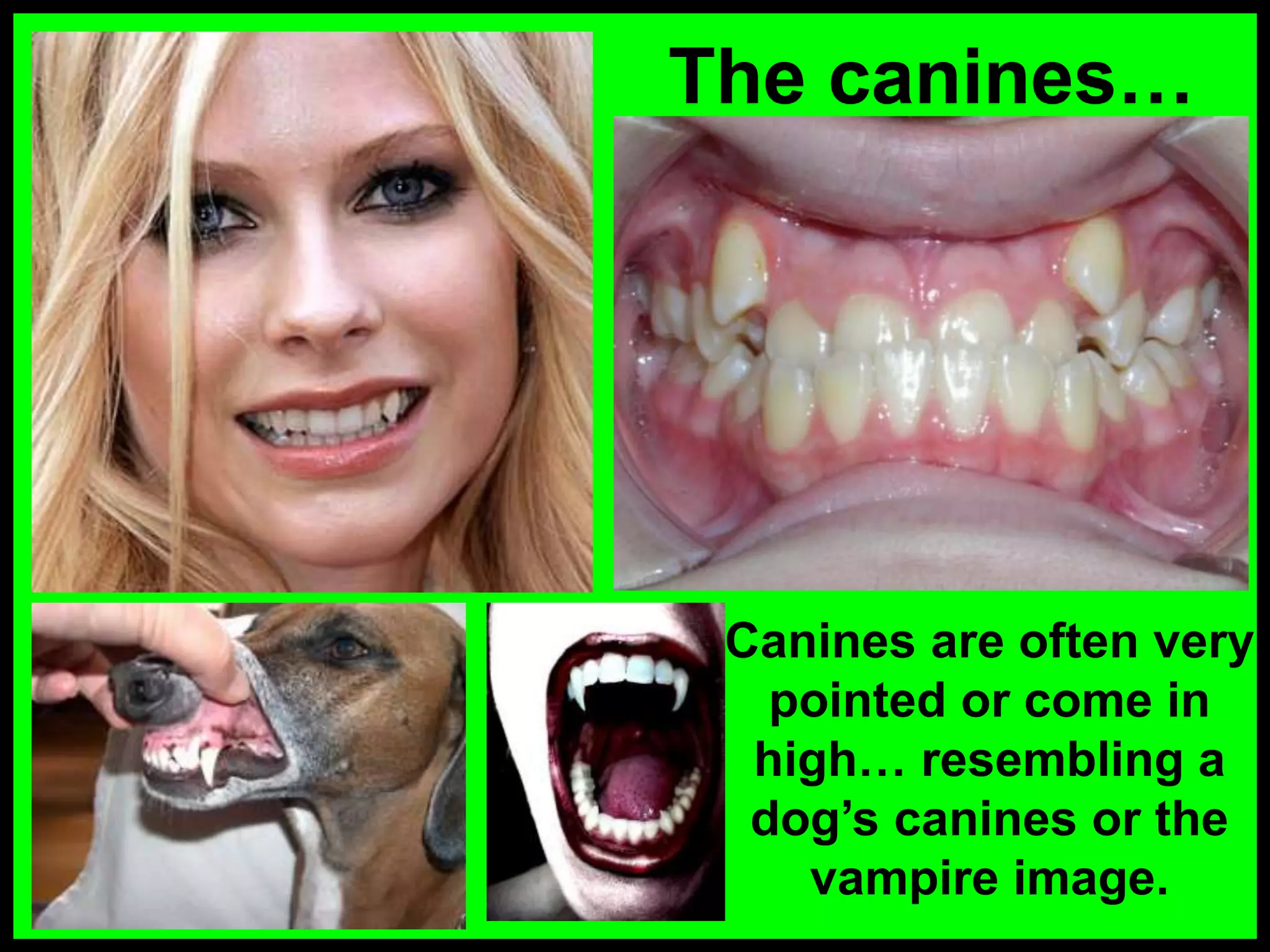 174-Anatomy-Teeth-and-Gums.ppt
