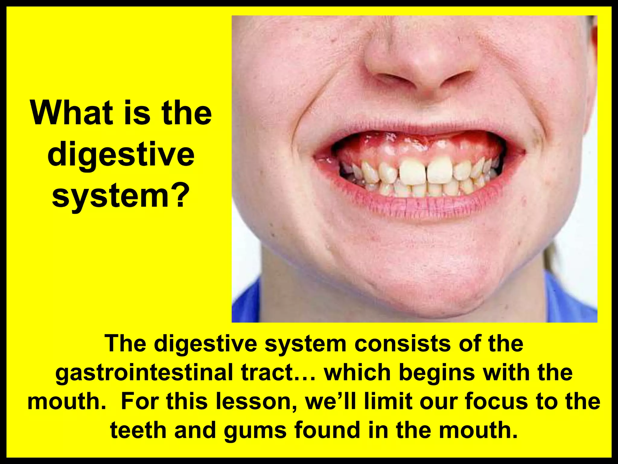 174-Anatomy-Teeth-and-Gums.ppt