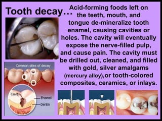 174-Anatomy-Teeth-and-Gums.ppt