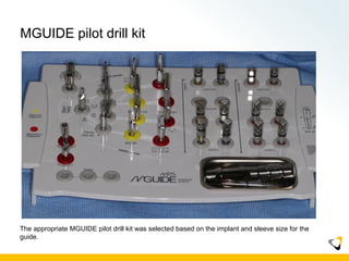 CS3600 Implant Case Presentation | PPT