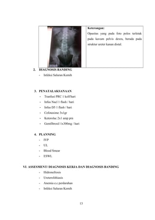 178408818 case-hidronefrosis | DOC