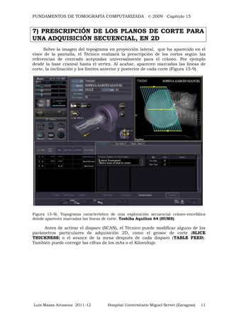 manual-de-usuario-de-tomografia-computarizada-user-s-manual-toshiba ...