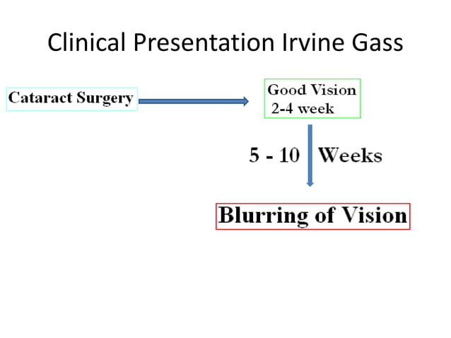 irvine gass syndrome | PPT