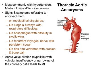 17971_27.2_Aneurysm.ppt