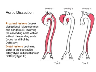 17971_27.2_Aneurysm.ppt
