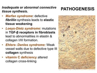 17971_27.2_Aneurysm.ppt