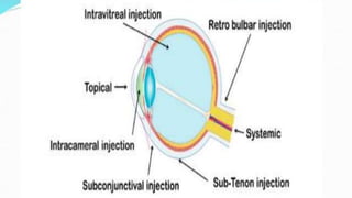 Nanotechnology in ocular drug delivery system | PPT