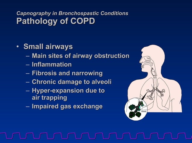 17 capnography part4 non-intubated | PPT