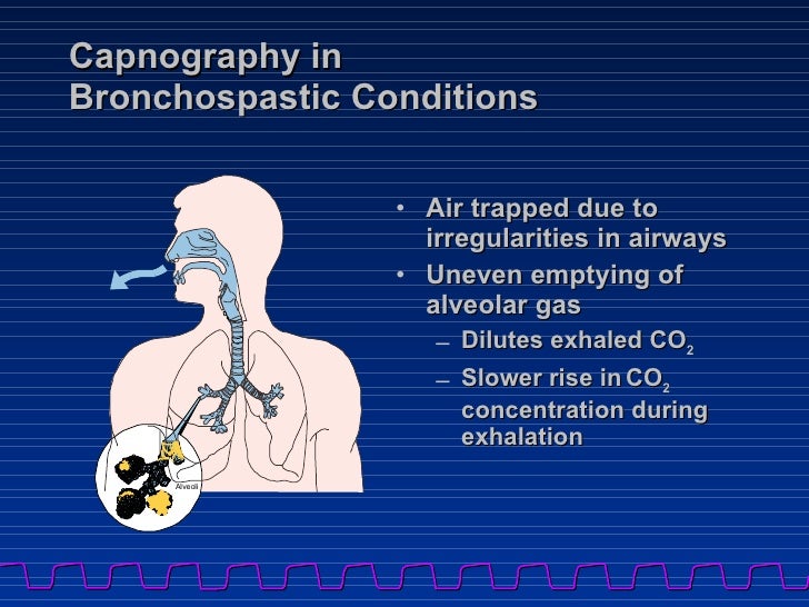 17 capnography part4 non-intubated