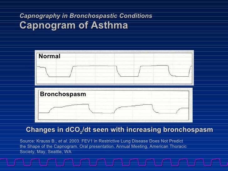 17 capnography part4 non-intubated