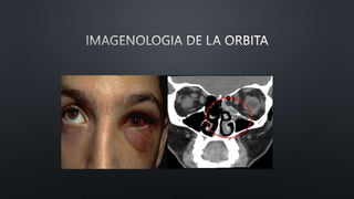 17 CLASE SVO IMAGENOLOGIA DE LA ORBITA - Dra. Moreno.pptx
