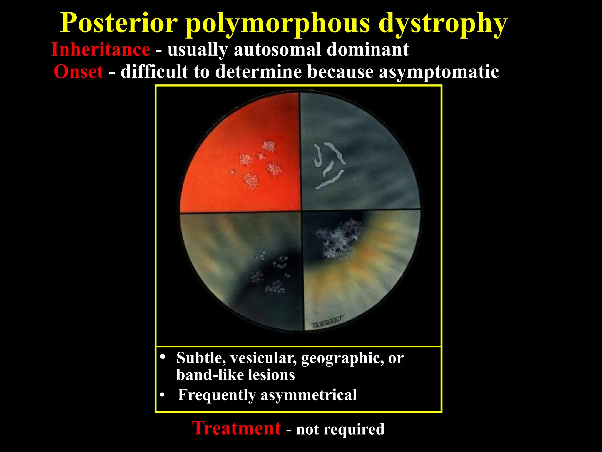 Corneal Dystrophies.ppt