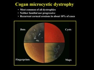 Corneal Dystrophies.ppt
