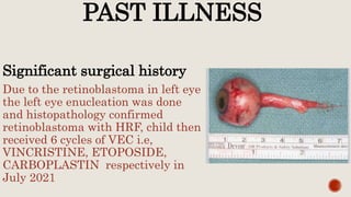 Retinoblastoma | PPTX