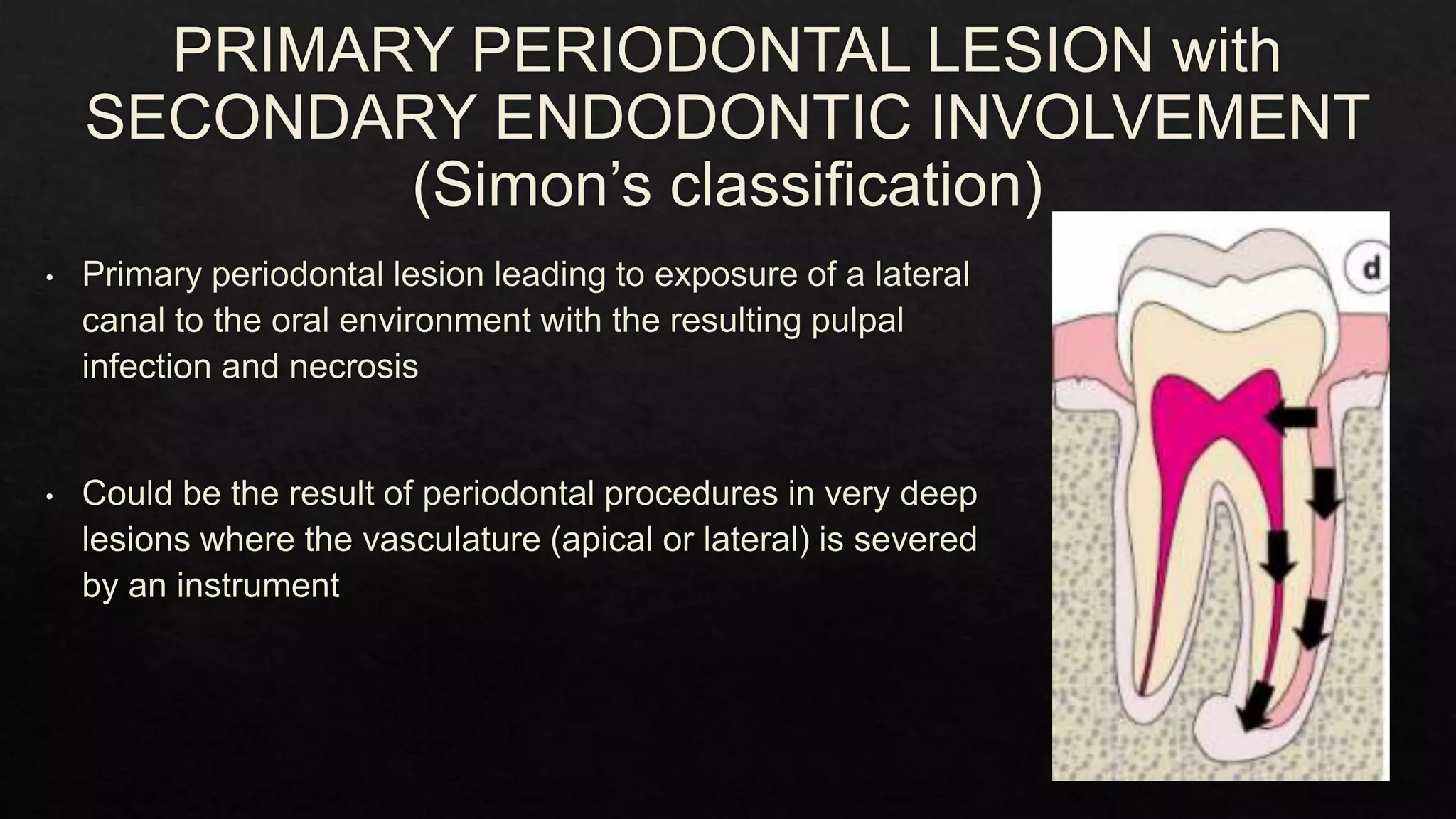 ENDO-PERIO LESIONS | PPTX