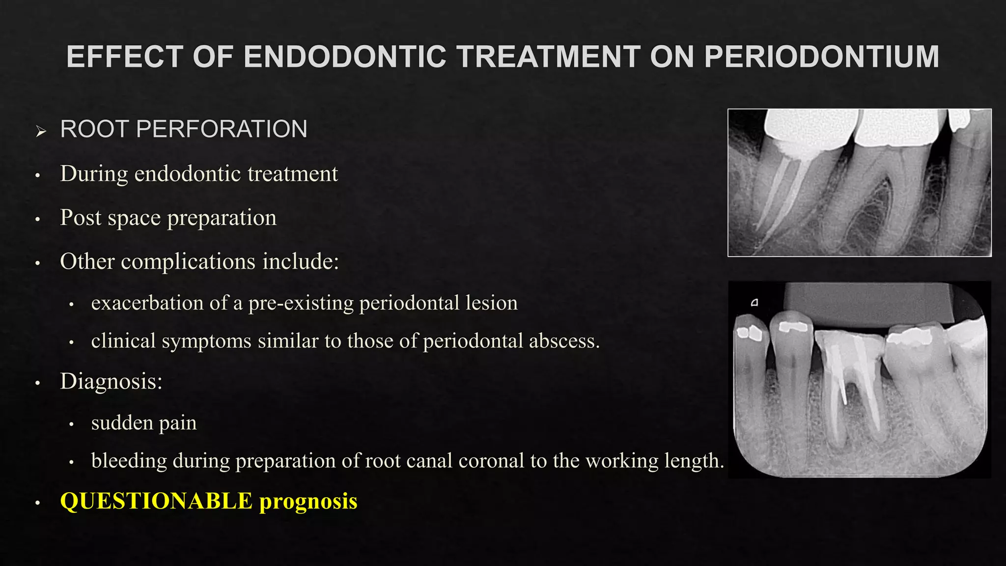 ENDO-PERIO LESIONS | PPTX