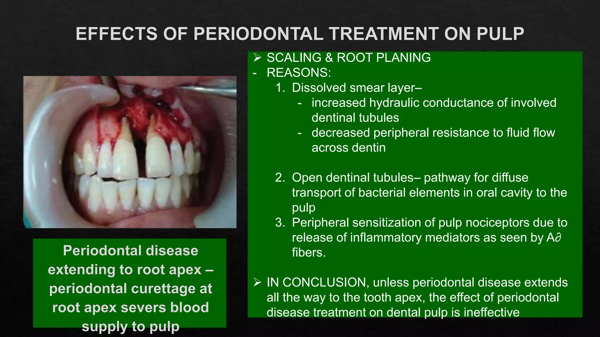 ENDO-PERIO LESIONS | PPTX