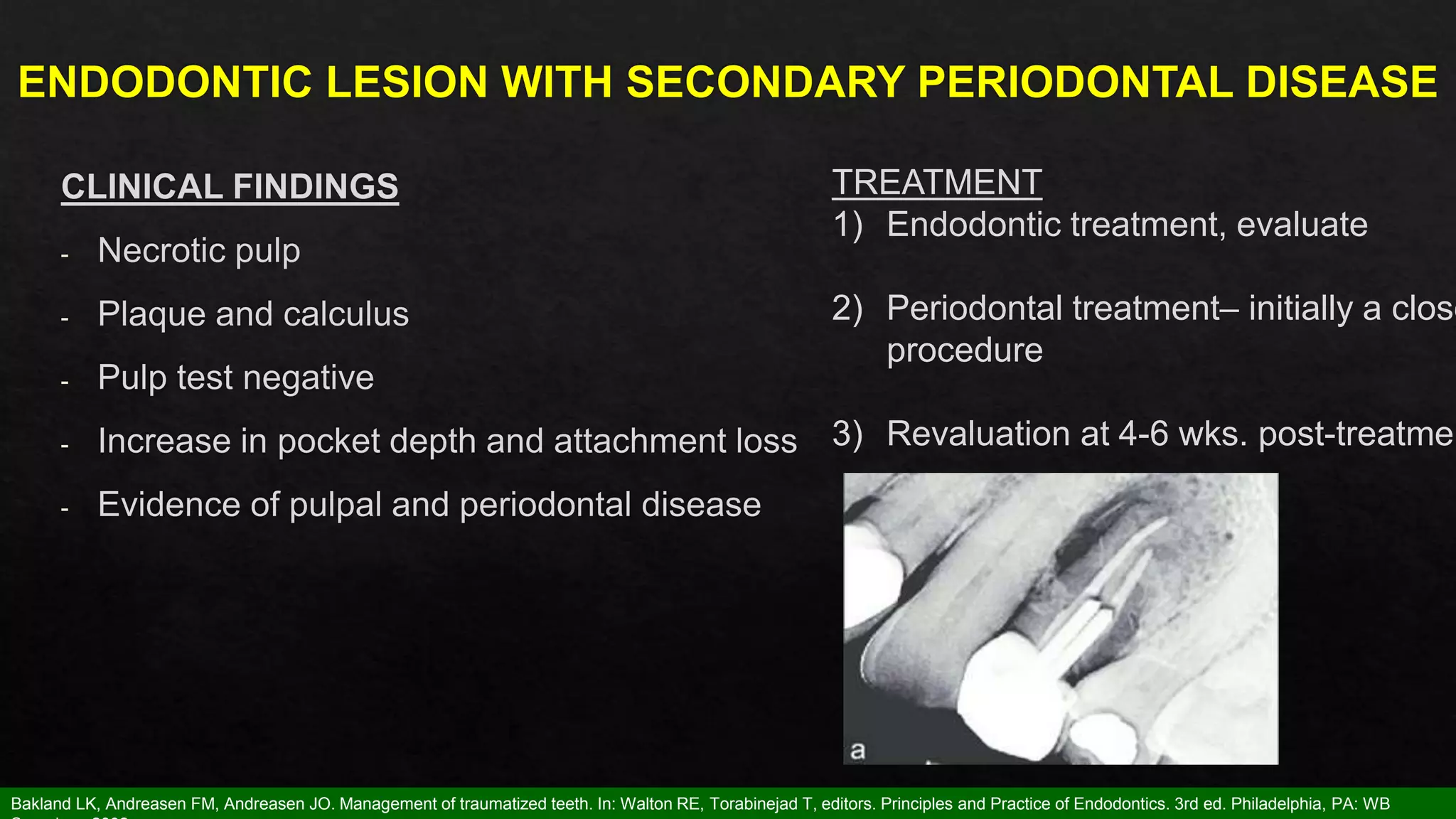 ENDO-PERIO LESIONS | PPTX
