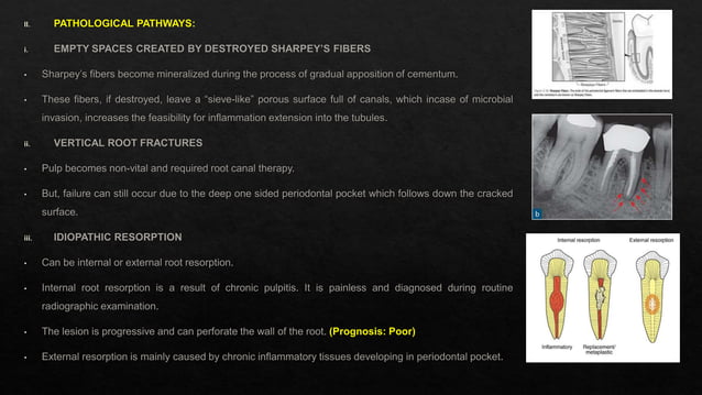 ENDO-PERIO LESIONS | PPTX | Dental Health | Diseases and Conditions