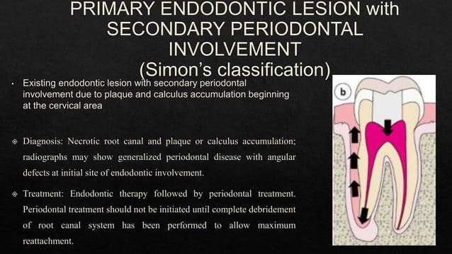 ENDO-PERIO LESIONS | PPTX | Dental Health | Diseases and Conditions