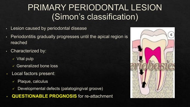ENDO-PERIO LESIONS | PPTX | Dental Health | Diseases and Conditions