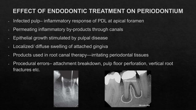 ENDO-PERIO LESIONS | PPTX | Dental Health | Diseases and Conditions