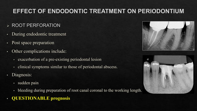 ENDO-PERIO LESIONS | PPTX | Dental Health | Diseases and Conditions